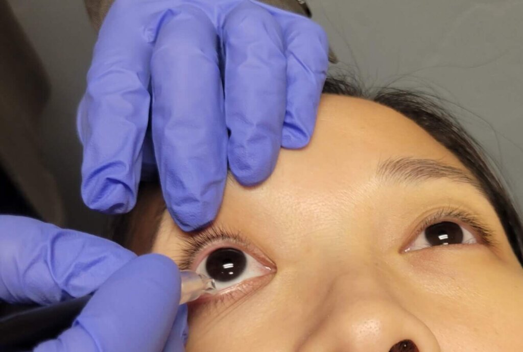 What to Expect: Diode Cyclophotocoagulation (diode CPC) - Arizona Eye ...